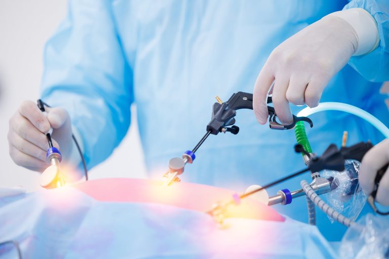 Laparoscopic Surgery for Endometriosis: What to Know